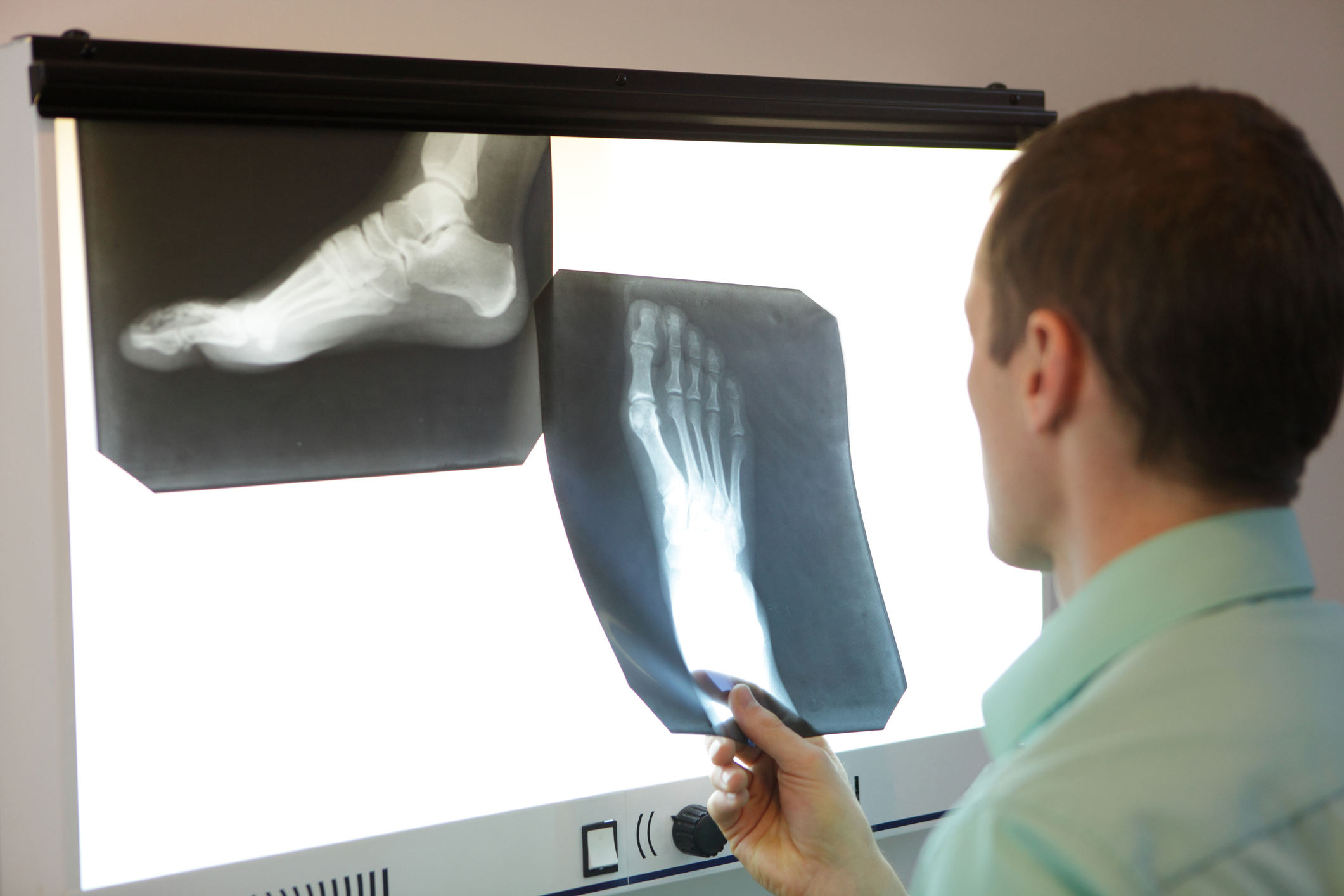 Stubbed Or Broken Toe? How To Tell And When To Seek Treatment